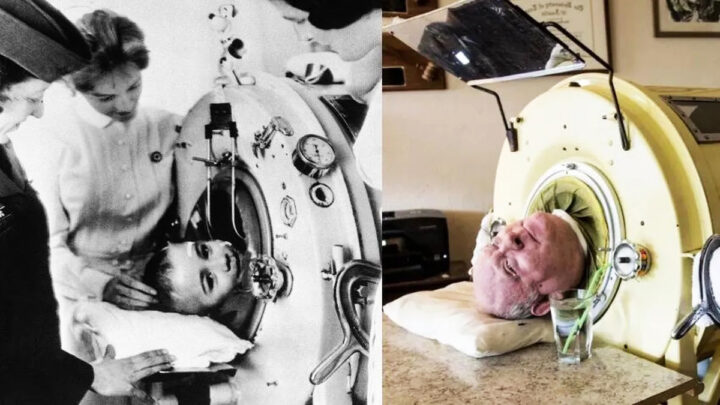 Muere a los 78 años “el hombre del pulmón de acero” Paul Alexander ...